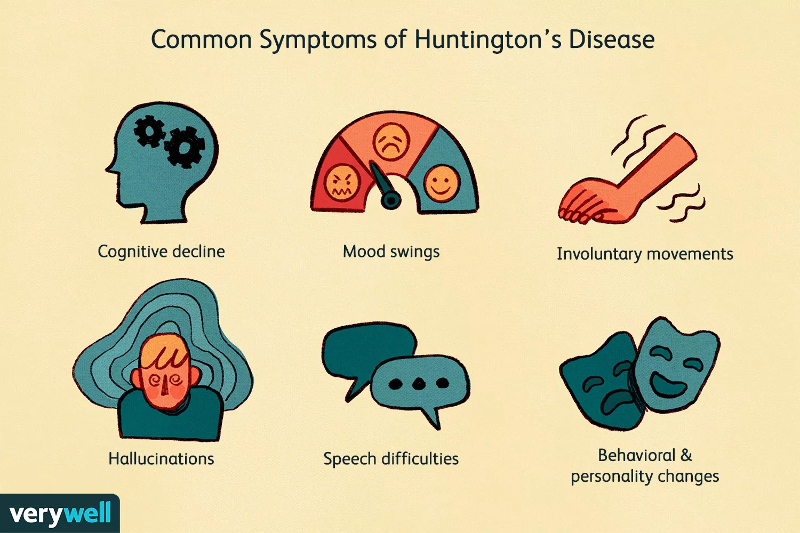 Huntington’s disease